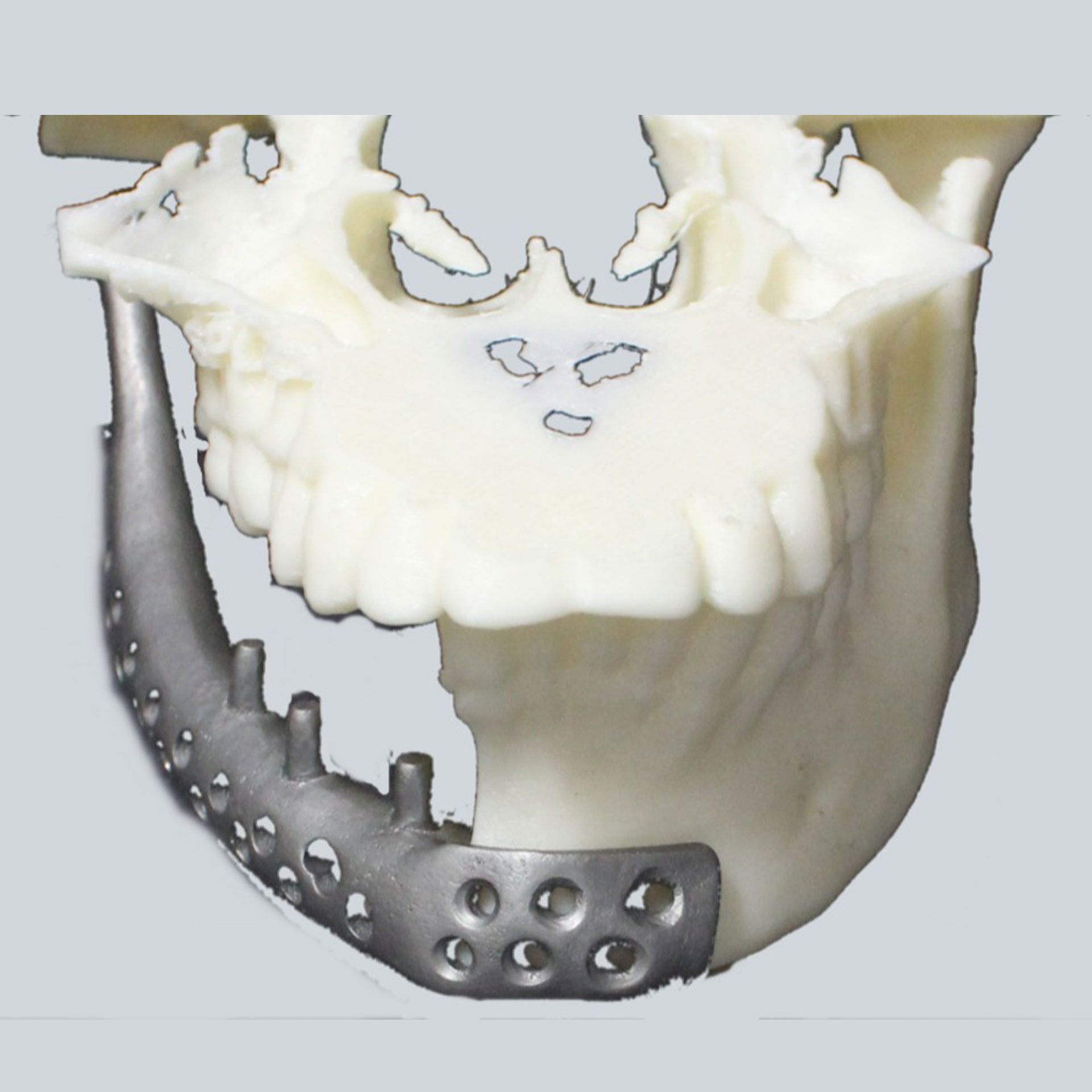 Oral And Maxillofacial - Anatomiz3D